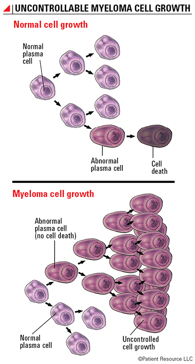 Immunotherapy - Multiple Myeloma